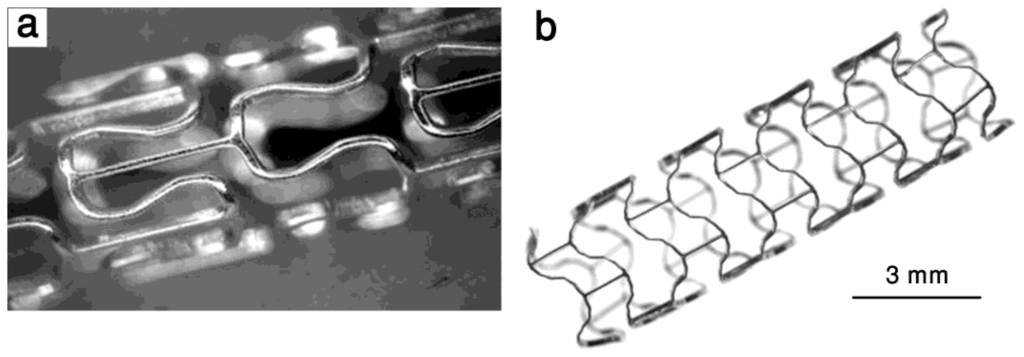 Biodegradable Metals for Cardiovascular Stent Application: Interests ...