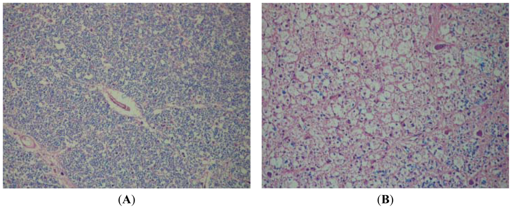 IJMS | Free Full-Text | Proteomic Analysis of Cerebrospinal Fluid in a ...