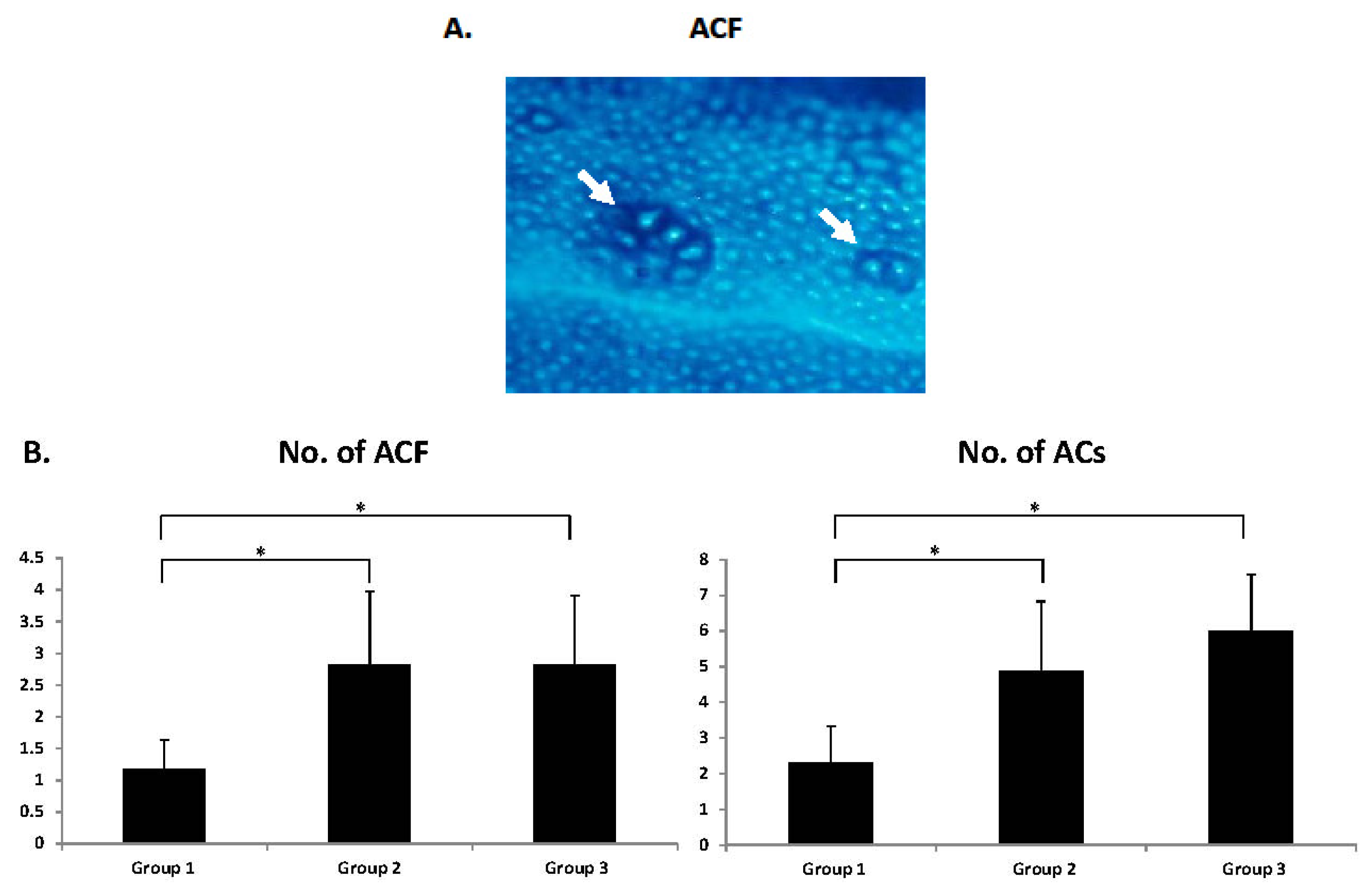 Enhanced Development of Azoxymethane-Induced Colonic Preneoplastic ...