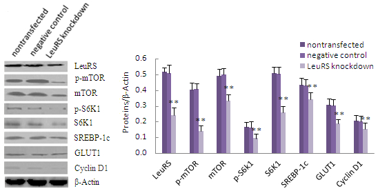 IJMS | Free Full-Text | Leucyl-tRNA Synthetase Regulates Lactation and ...
