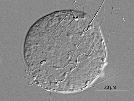 IJMS | Free Full-Text | Sperm-Egg Fusion: A Molecular Enigma of ...