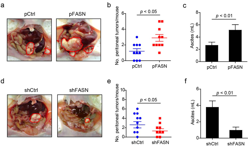 Up-Regulated FASN Expression Promotes Transcoelomic Metastasis of ...