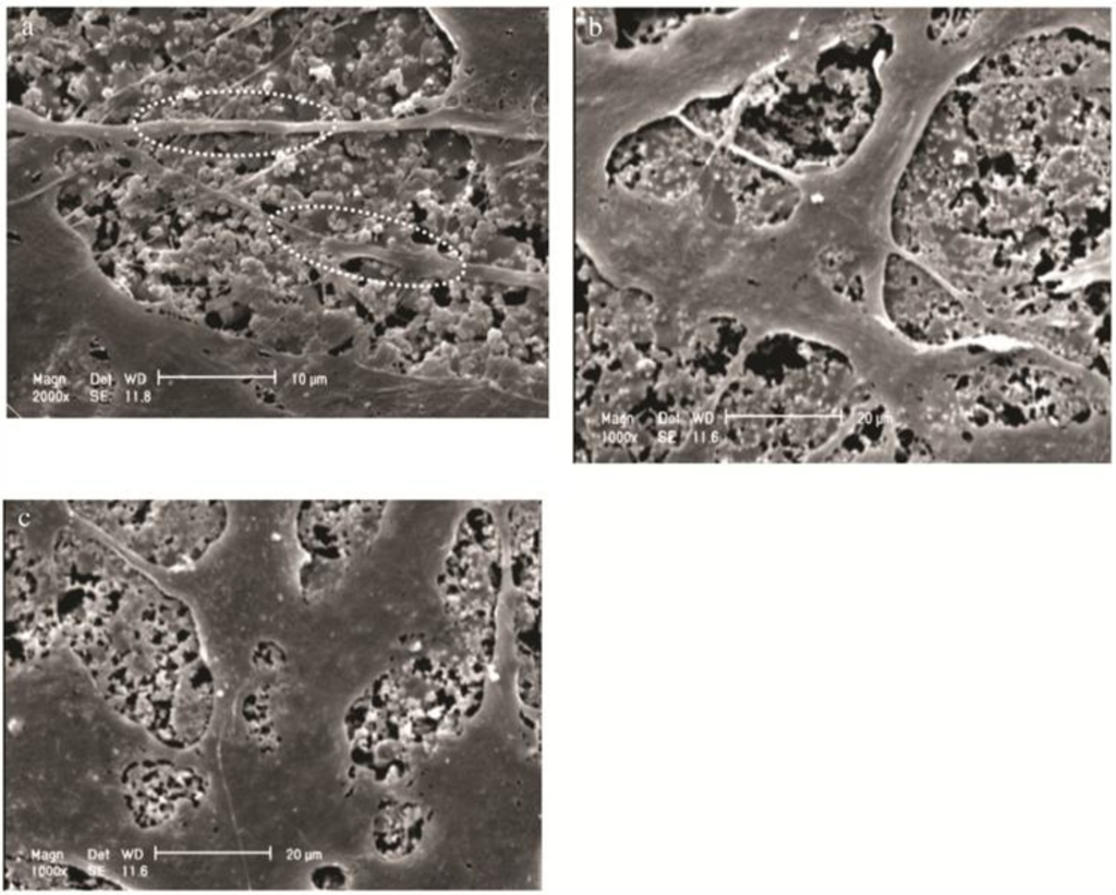 Bioactive Coatings for Orthopaedic Implants—Recent Trends in ...