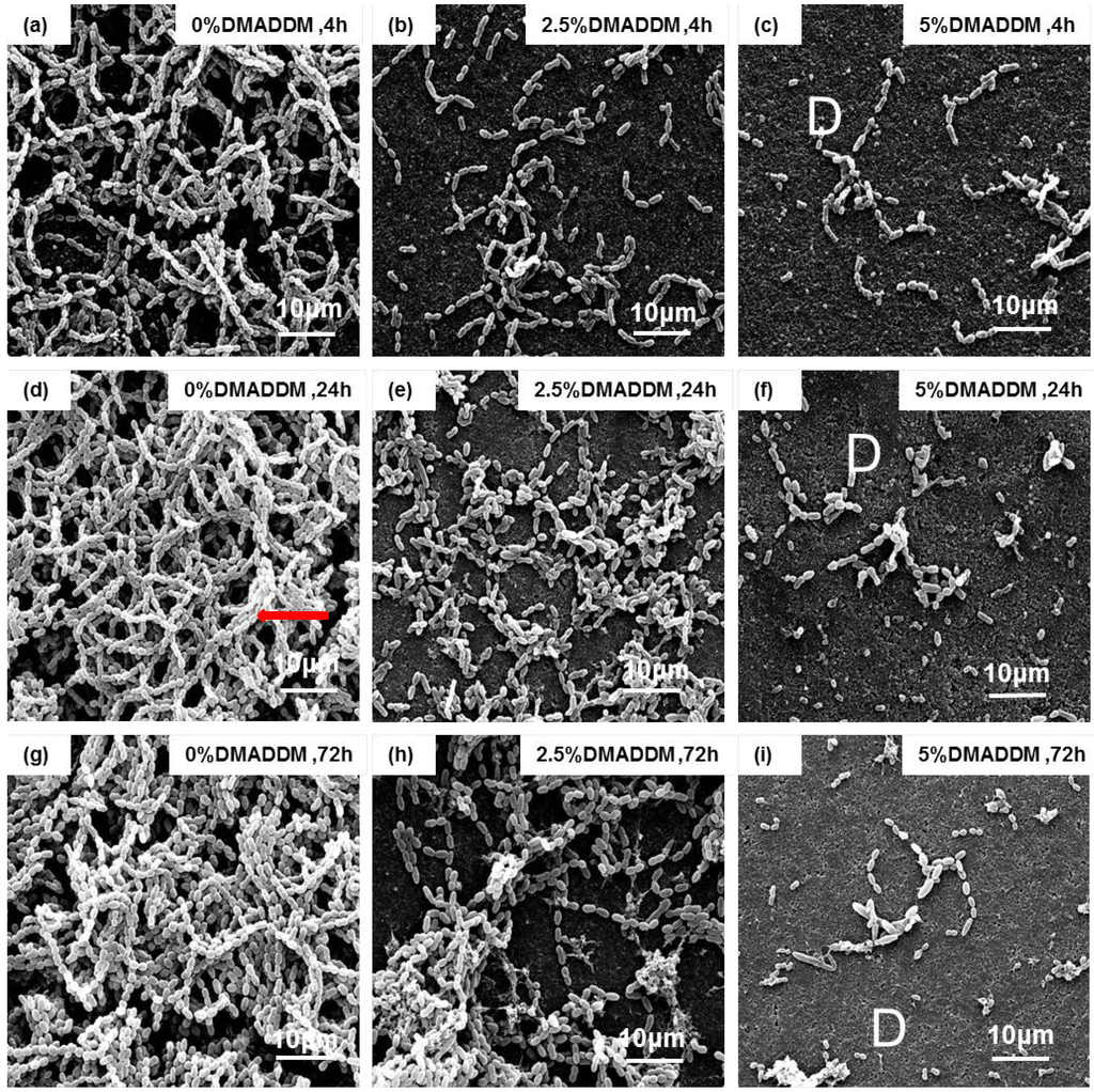 Antibacterial Effect of Dental Adhesive Containing Dimethylaminododecyl ...