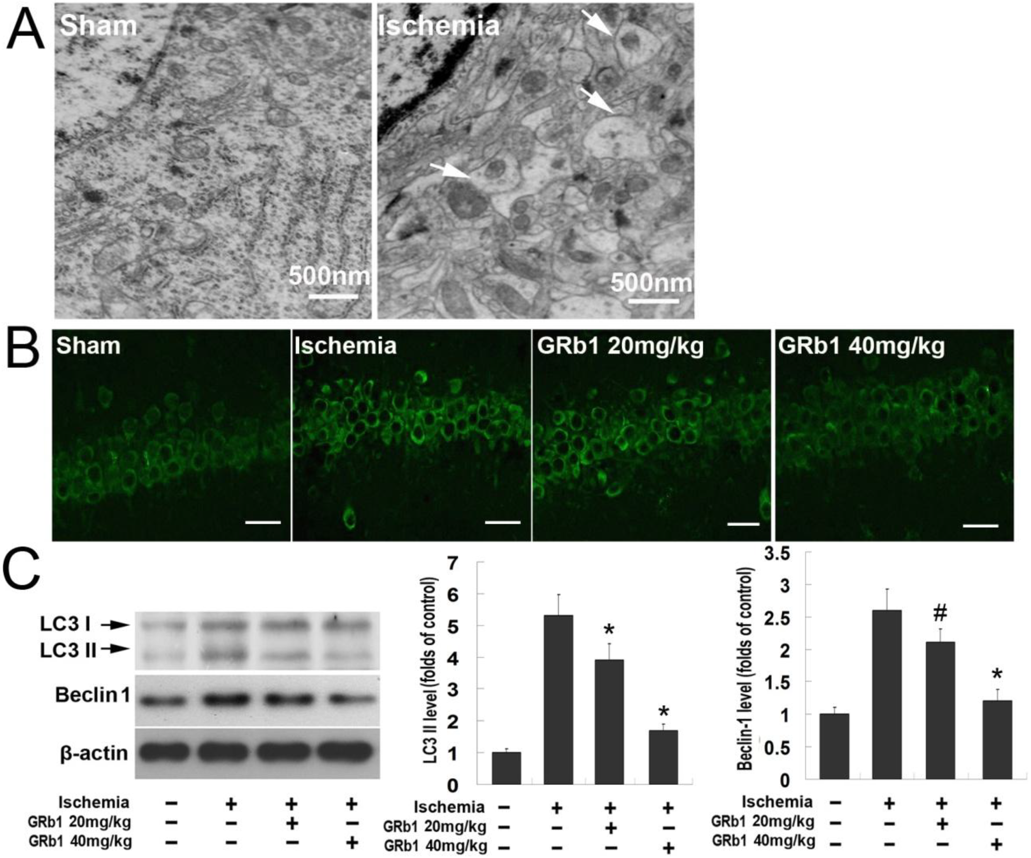 Inhibition of Autophagy via Activation of PI3K/Akt Pathway Contributes ...