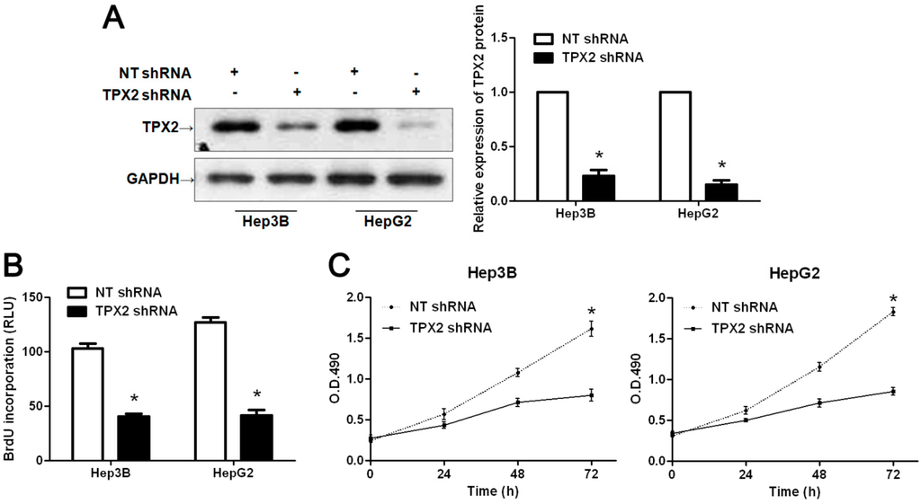 TPX2 Is a Prognostic Marker and Contributes to Growth and Metastasis of ...