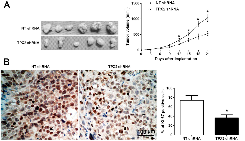 TPX2 Is a Prognostic Marker and Contributes to Growth and Metastasis of ...