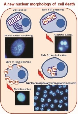 IJMS | Free Full-Text | Regulated Necrosis in HeLa Cells Induced by ...