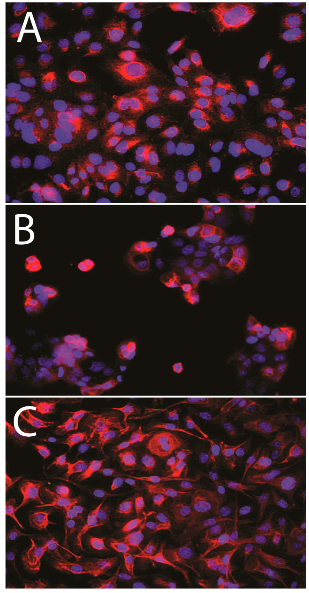 IJMS | Free Full-Text | Expression of the MT1 Melatonin Receptor in ...