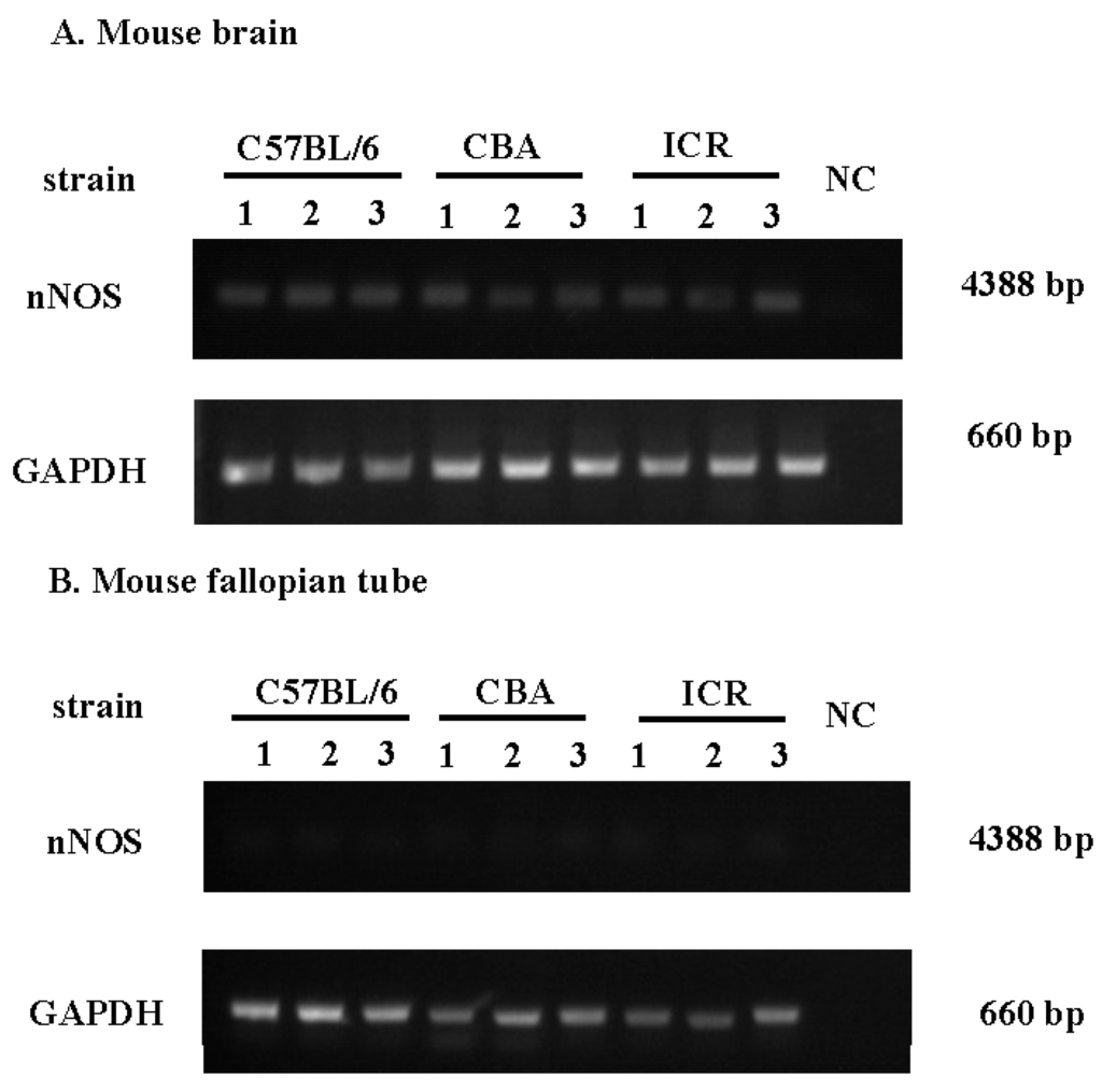 The Regulation of Nitric Oxide Synthase Isoform Expression in Mouse and ...