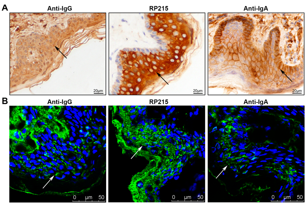 IgG and IgA with Potential Microbial-Binding Activity Are Expressed by ...