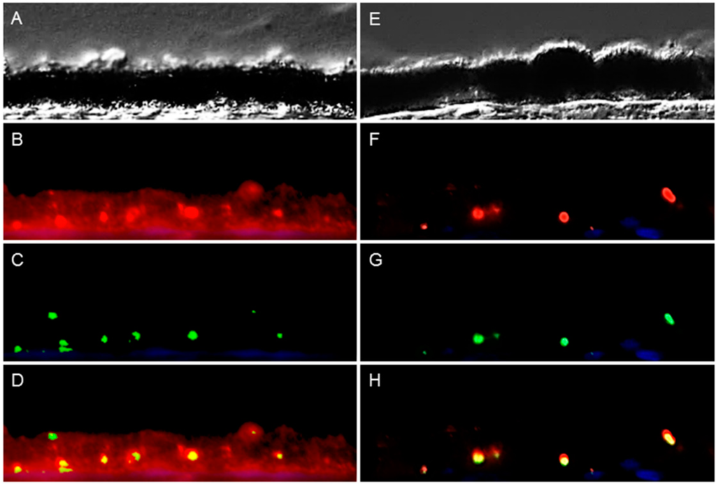 Novel Localization of Peripherin 2, the Photoreceptor-Specific Retinal ...