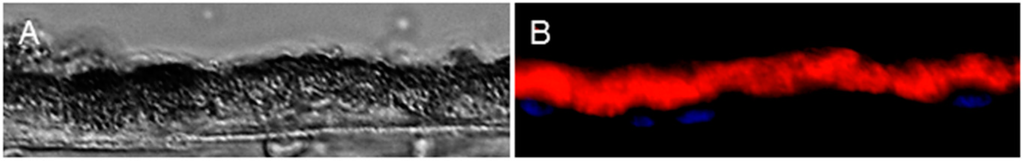 Novel Localization of Peripherin 2, the Photoreceptor-Specific Retinal ...