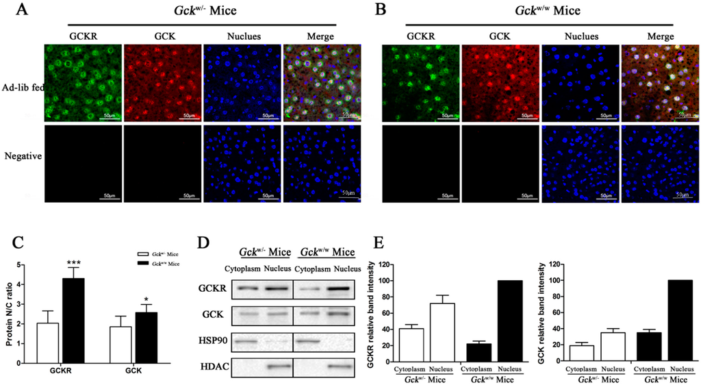 Role of Glucokinase in the Subcellular Localization of Glucokinase ...