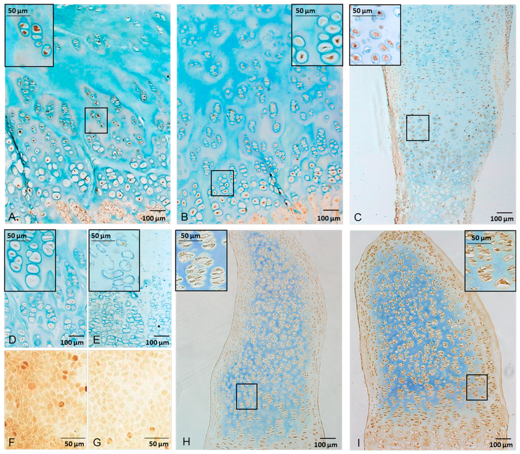 Expression of the Aryl Hydrocarbon Receptor in Growth Plate Cartilage ...