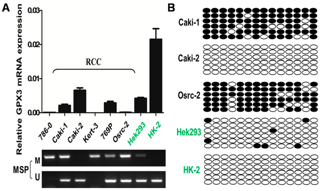 Frequent Epigenetic Suppression of Tumor Suppressor Gene Glutathione ...