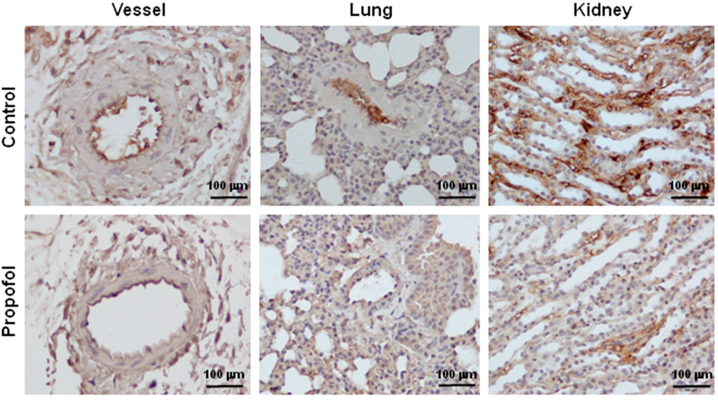 IJMS | Free Full-Text | Anesthetic Propofol Overdose Causes Vascular ...