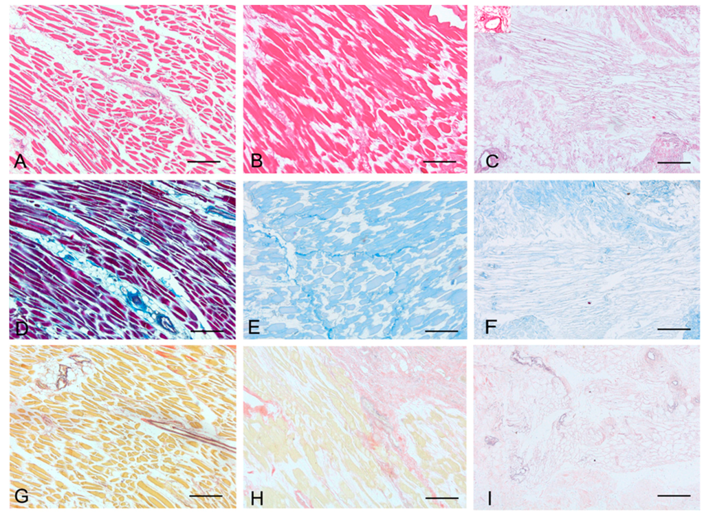 Human Skeletal Muscle Cells Skeletal Myoblasts