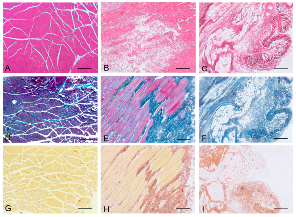 Decellularized Human Skeletal Muscle as Biologic Scaffold for ...