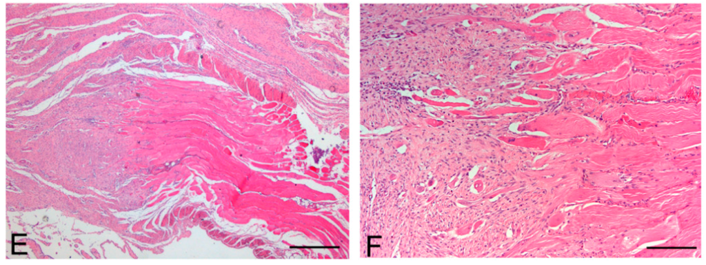 Decellularized Human Skeletal Muscle as Biologic Scaffold for ...