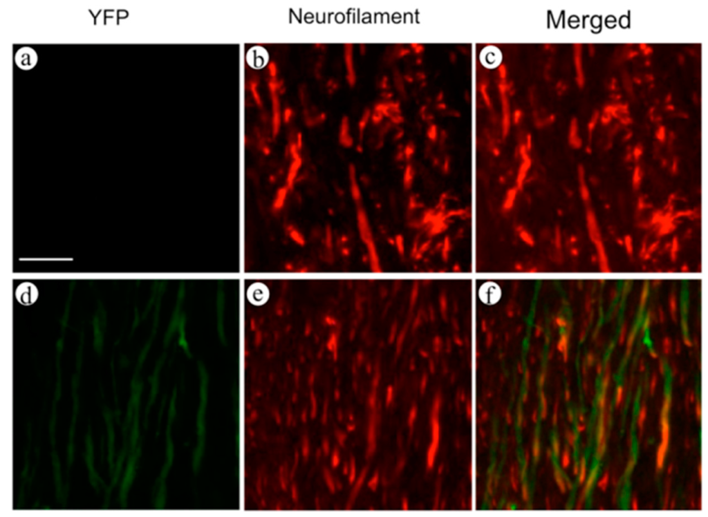 Evaluation of Injured Axons Using Two-Photon Excited Fluorescence ...