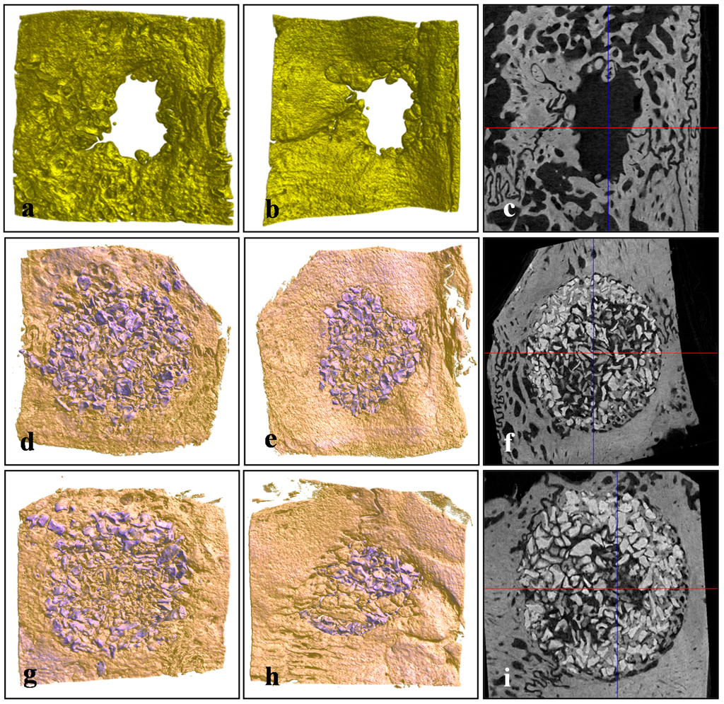 Effect of rhBMP-2 Immobilized Anorganic Bovine Bone Matrix on Bone ...