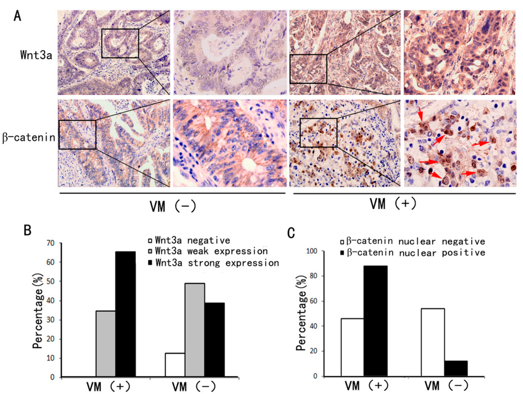 IJMS | Free Full-Text | Wnt3a Promotes the Vasculogenic Mimicry ...