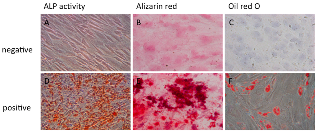 IJMS | Special Issue : Apoptotic Chondrocytes and Osteoarthritis