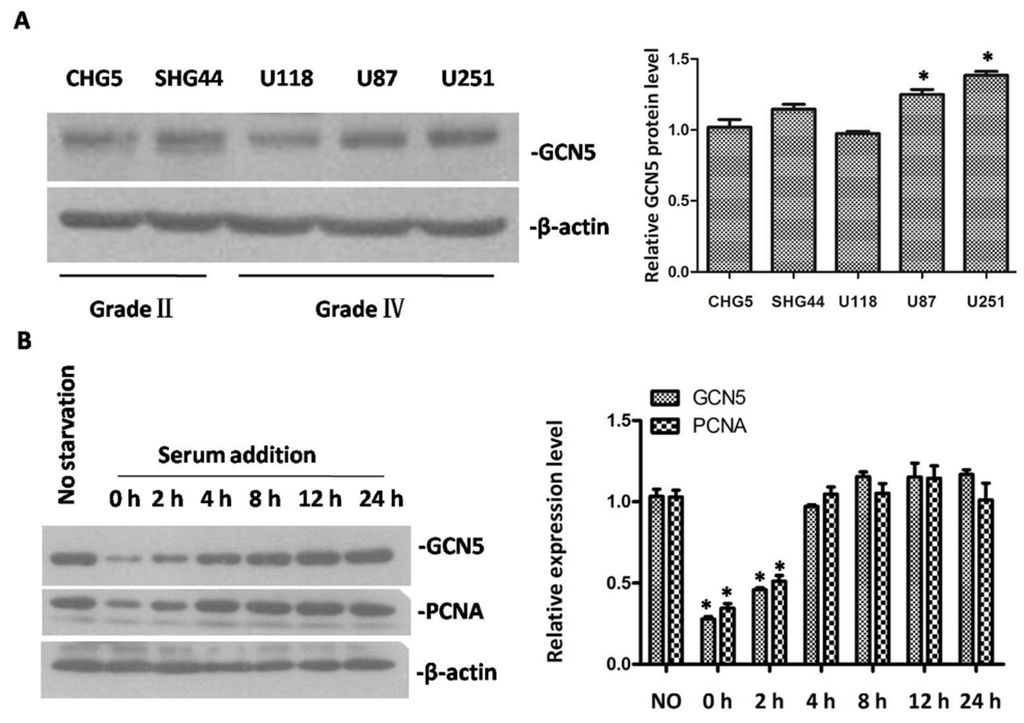 IJMS | Free Full-Text | GCN5 Potentiates Glioma Proliferation and ...
