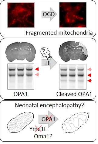 IJMS | Free Full-Text | Mitochondrial Optic Atrophy (OPA) 1 Processing ...