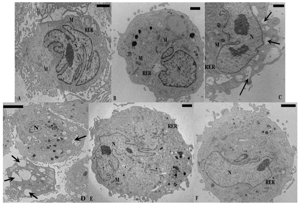 IJMS | Free Full-Text | Changes in Ultrastructure and Cytoskeletal ...