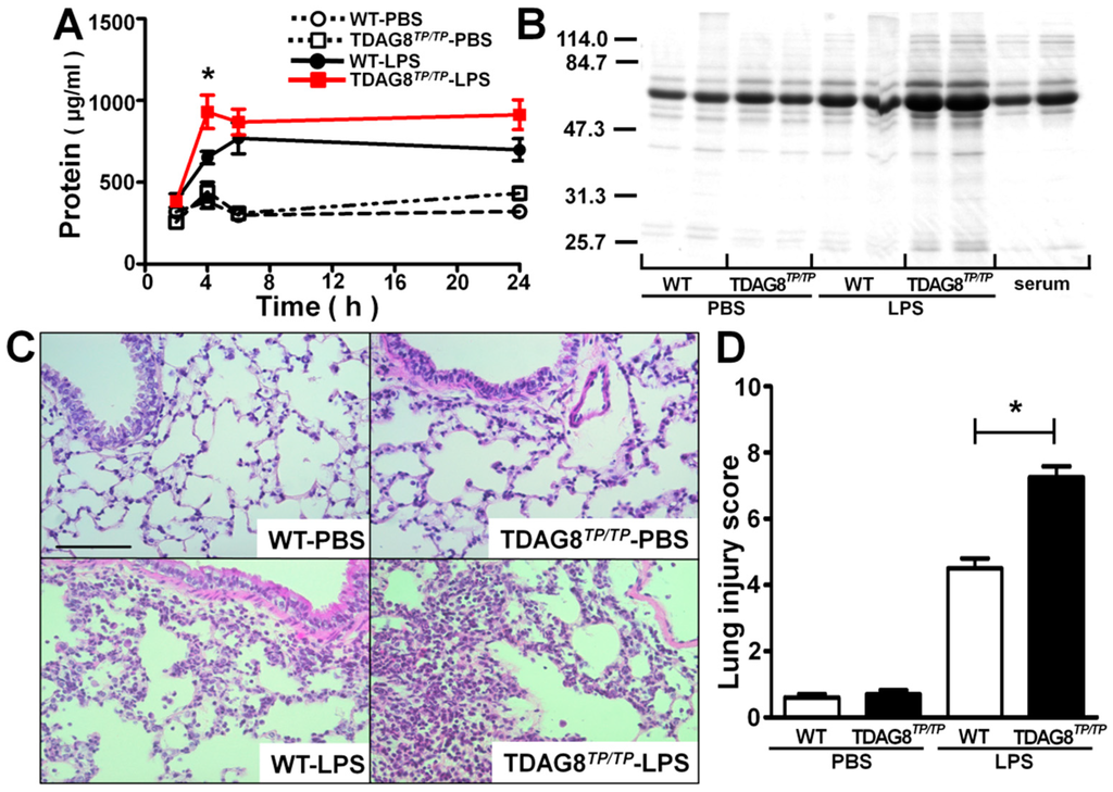 Protective Role of Proton-Sensing TDAG8 in Lipopolysaccharide-Induced ...
