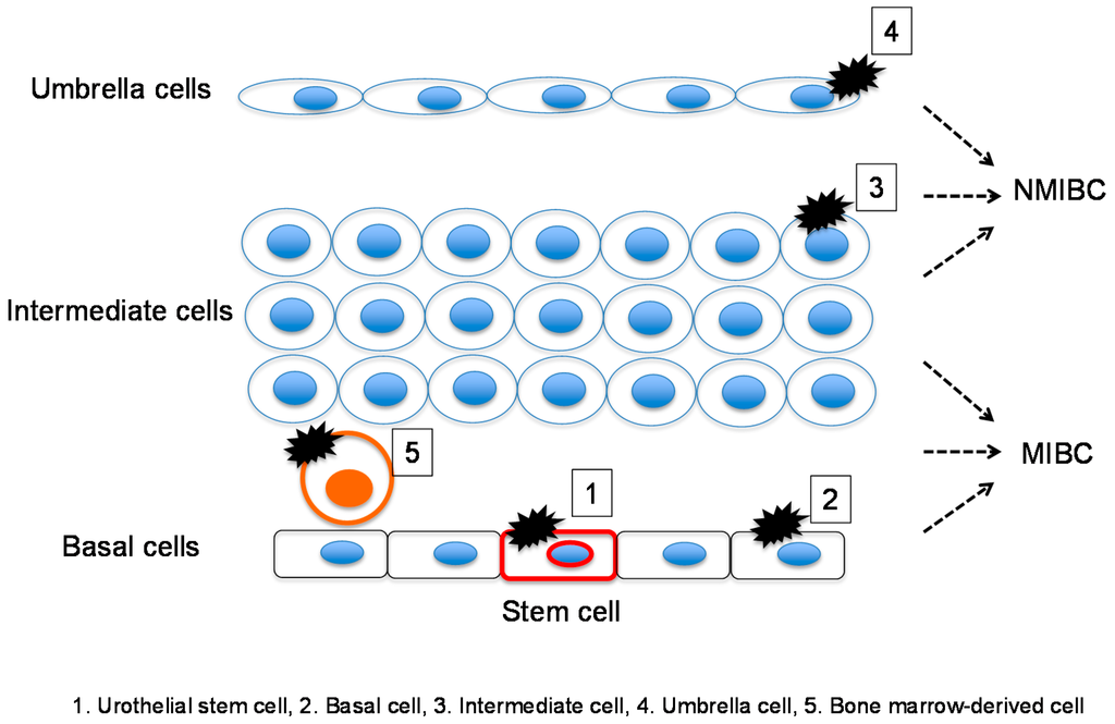 IJMS | Free Full-Text | Bladder Cancer Stem-Like Cells: Their Origin ...