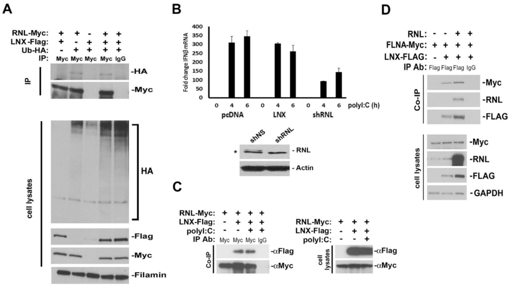The Roles of RNase-L in Antimicrobial Immunity and the Cytoskeleton ...