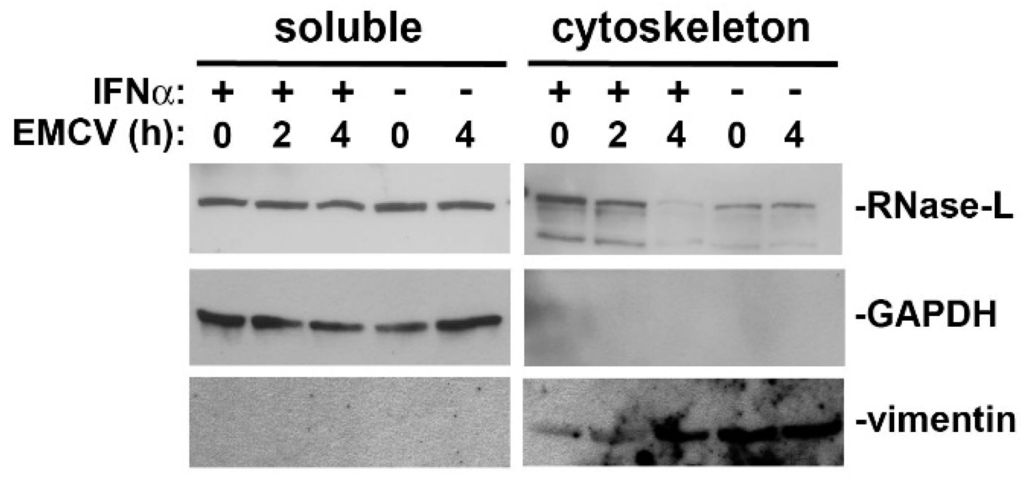The Roles of RNase-L in Antimicrobial Immunity and the Cytoskeleton ...