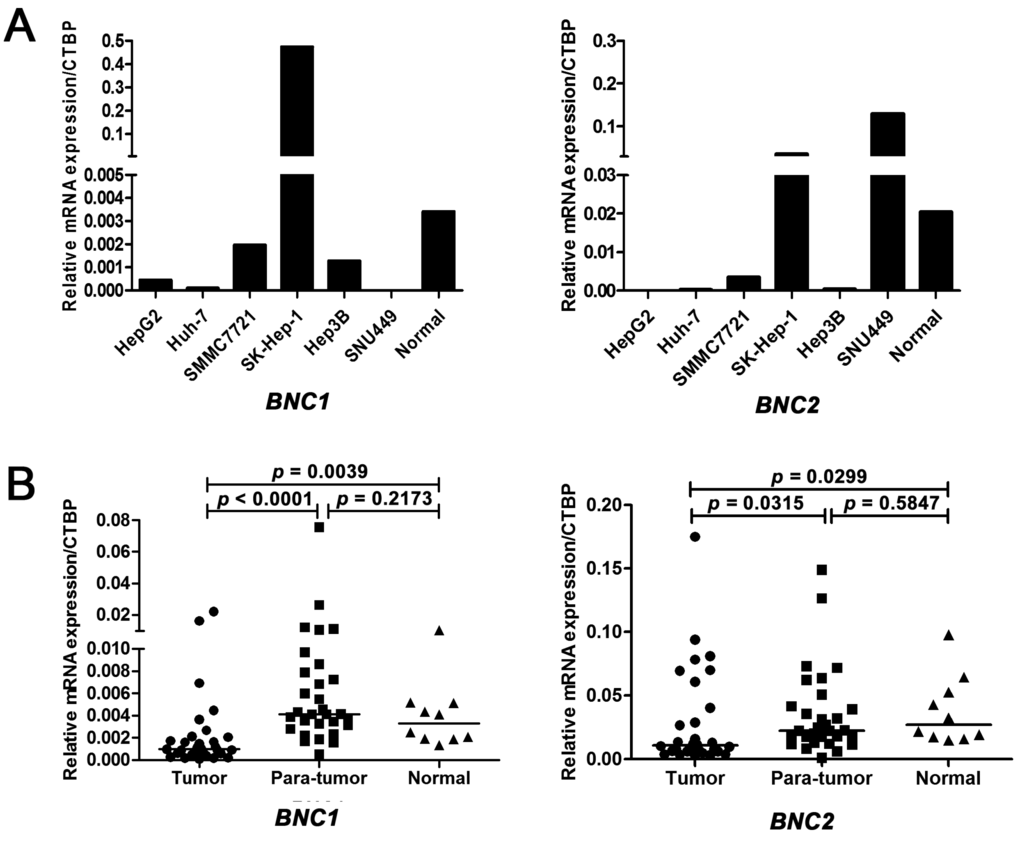 Decreased Expression of BNC1 and BNC2 Is Associated with Genetic or ...