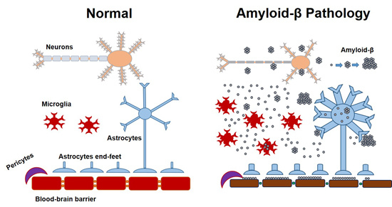 IJMS | Free Full-Text | Amyloid-β and Astrocytes Interplay in Amyloid-β ...