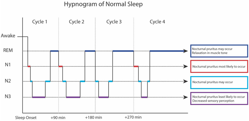 Nocturnal Pruritus: The Battle for a Peaceful Night’s Sleep