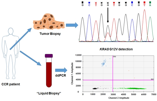 IJMS | Free Full-Text | KRAS G12V Mutation Detection by Droplet Digital PCR in Circulating Cell ...