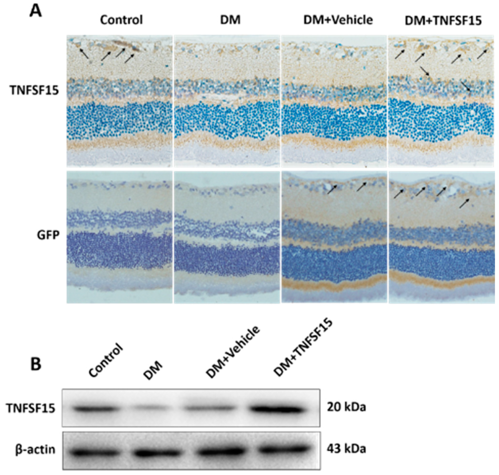 TNFSF15 Inhibits Blood Retinal Barrier Breakdown Induced by Diabetes