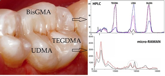 IJMS | Free Full-Text | Degree of Conversion and BisGMA, TEGDMA, UDMA ...