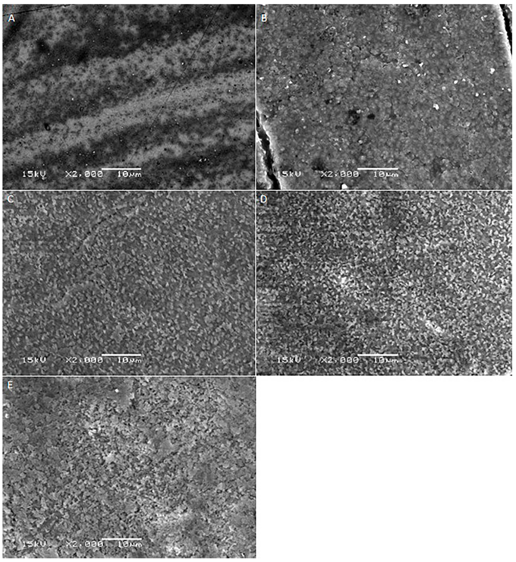 The Effect of Hydrofluoric Acid Etching Duration on the Surface ...