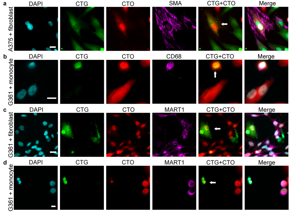 IJMS | Special Issue : Cell Fusion in Cancer