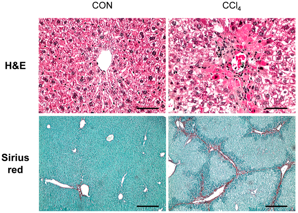 MicroRNA Expression Profiling in CCl4-Induced Liver Fibrosis of Mus ...
