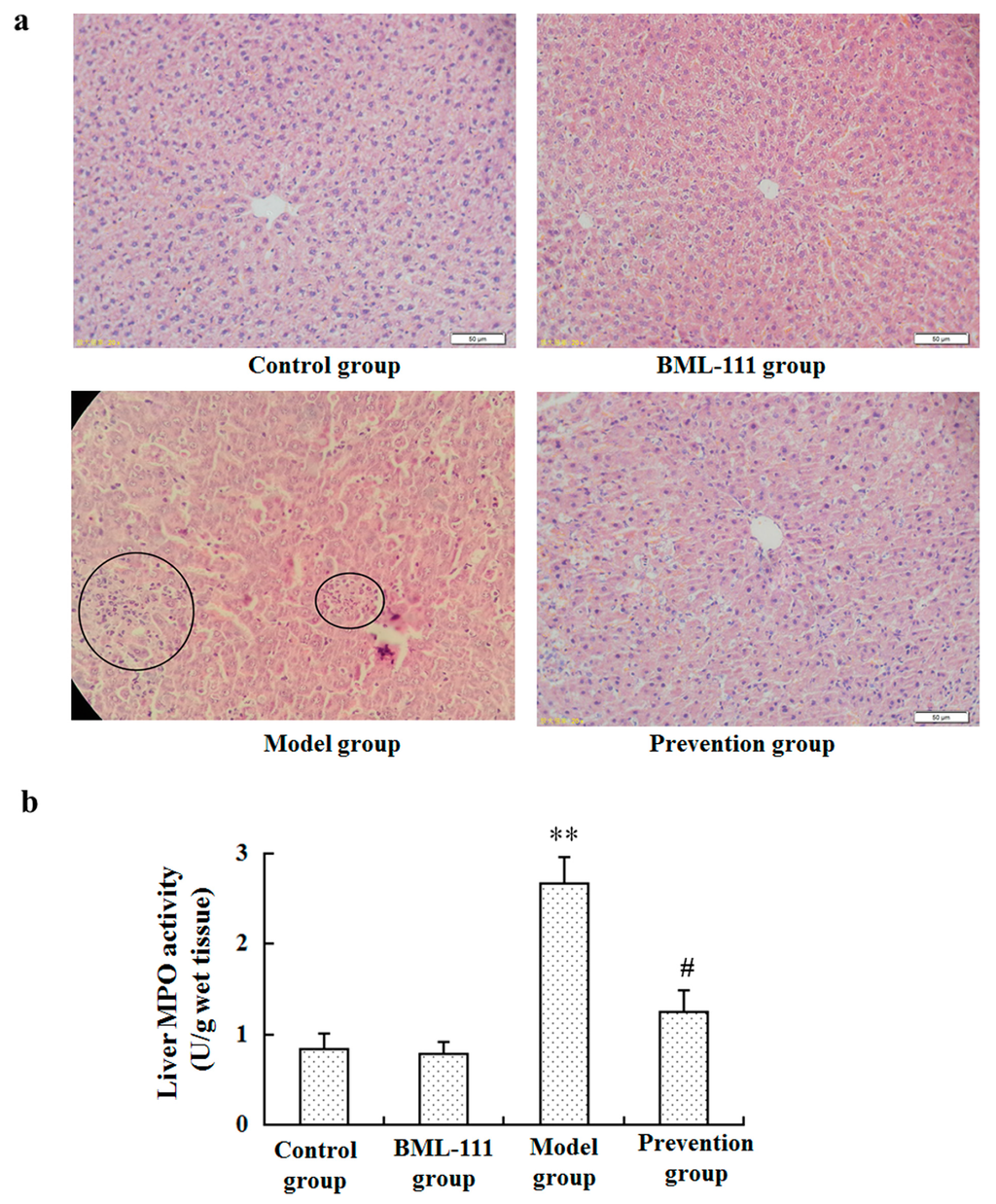 BML-111 Protected LPS/D-GalN-Induced Acute Liver Injury in Rats