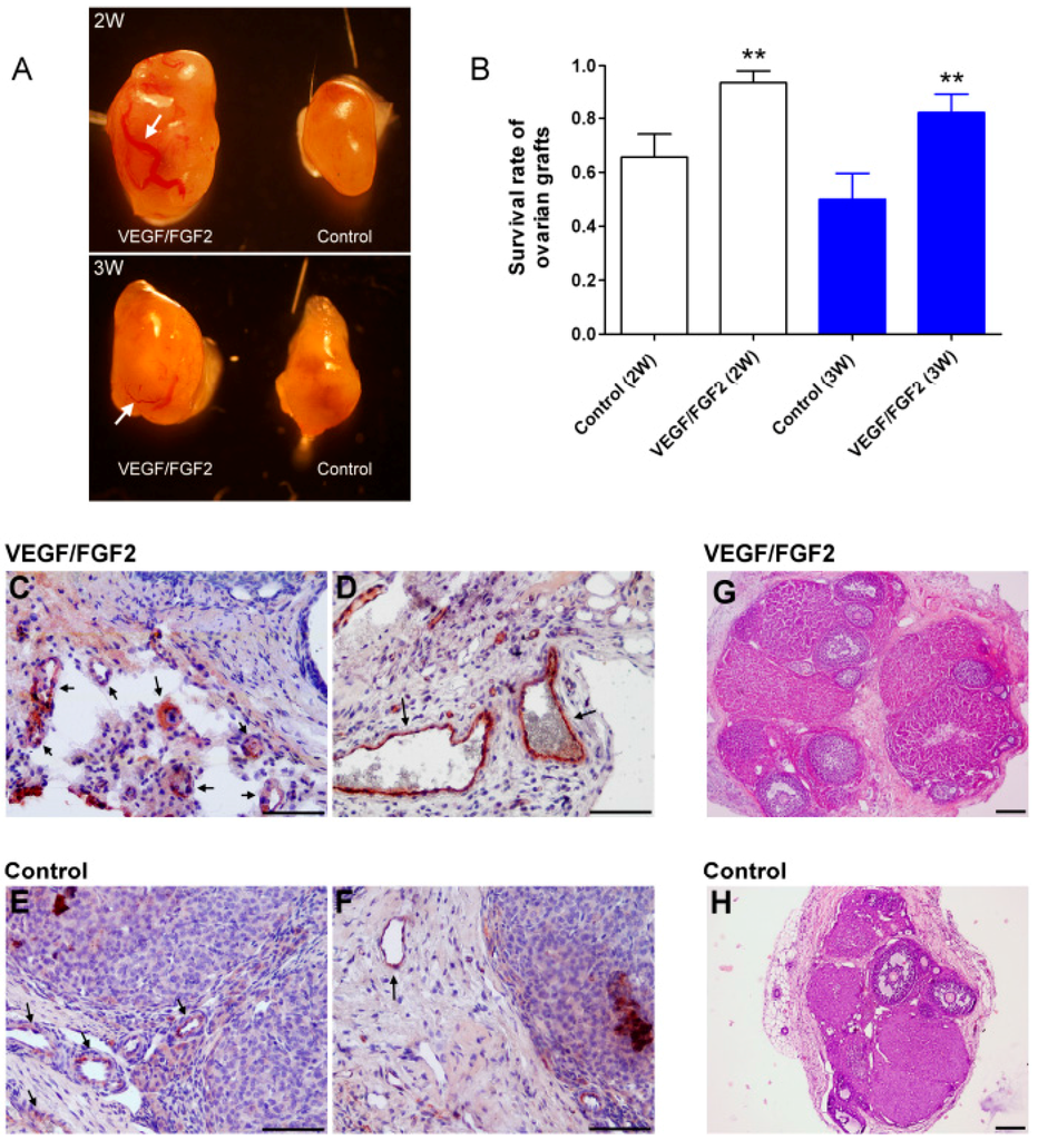 IJMS | Free Full-Text | VEGF and FGF2 Improve Revascularization ...