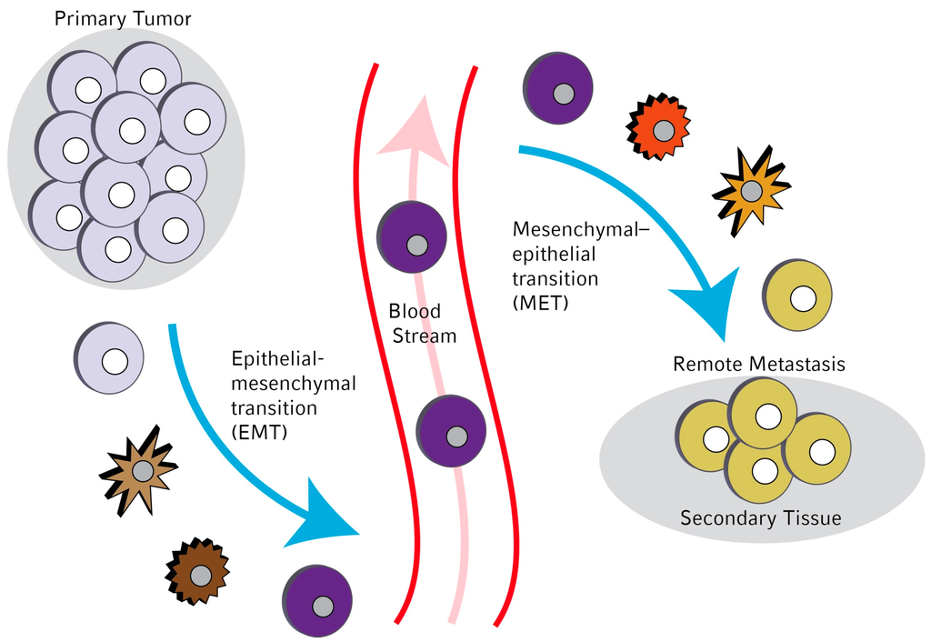 The Significance of Epithelial-to-Mesenchymal Transition for Circulating Tumor Cells