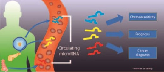 IJMS | Free Full-Text | Circulating MicroRNAs: A Next-Generation ... IJMS | Free Full-Text | Circulating MicroRNAs: A Next-Generation ...