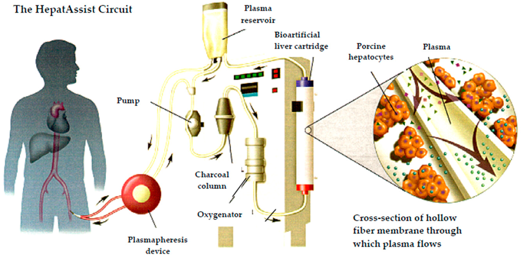 New Phase of Growth for Xenogeneic-Based Bioartificial Organs