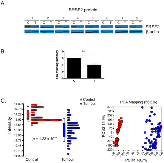Decreased Expression of SRSF2 Splicing Factor Inhibits Apoptotic ...